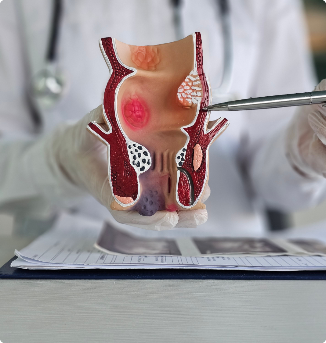 Proctologia | Centro Médico Alphaview